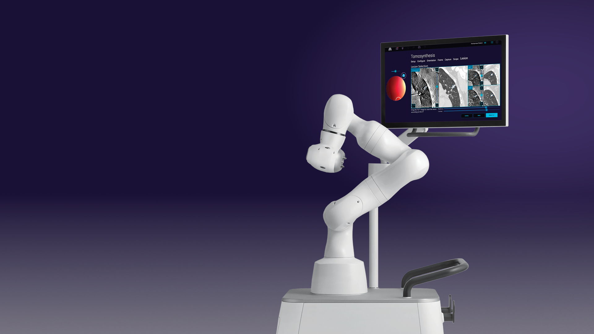 Meadville Medical Center Now Offers Next Generation Robotic ...